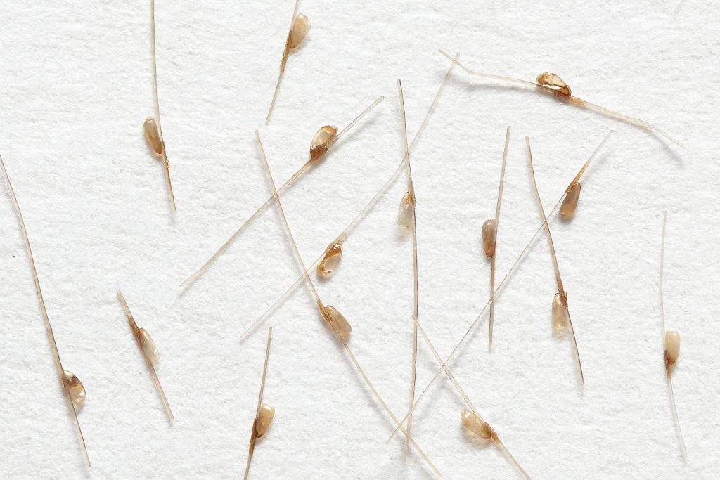 Imágenes de piojos y liendres ¿Qué nos pueden enseñar? | Piojos