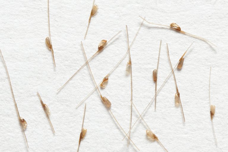 Imágenes de piojos y liendres ¿Qué nos pueden enseñar? | Piojos